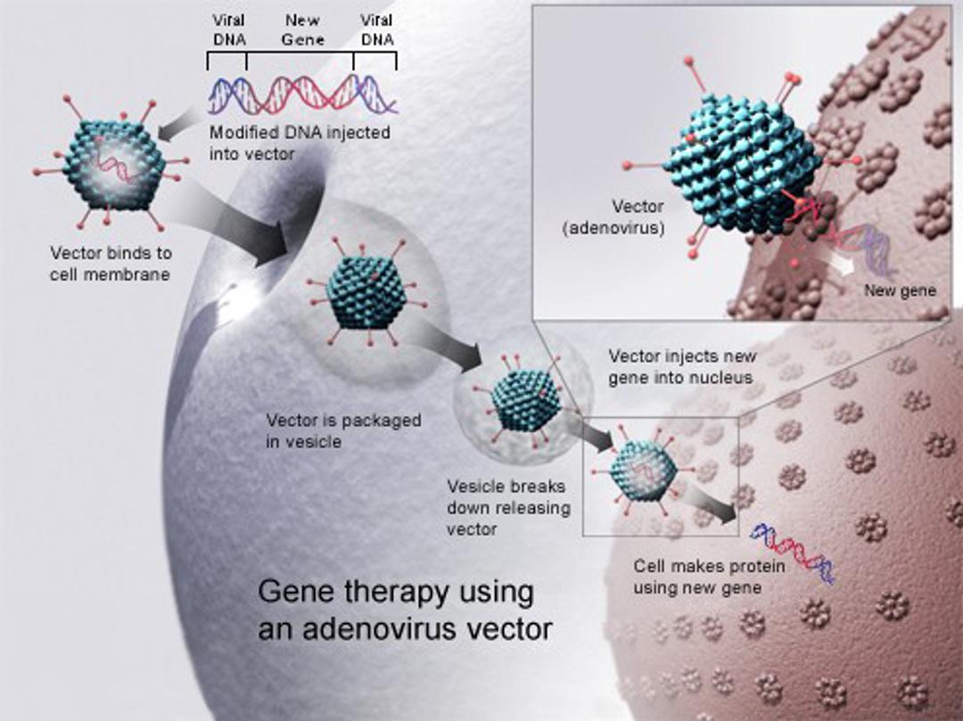 Glybera, la première thérapie génique autorisée en Europe