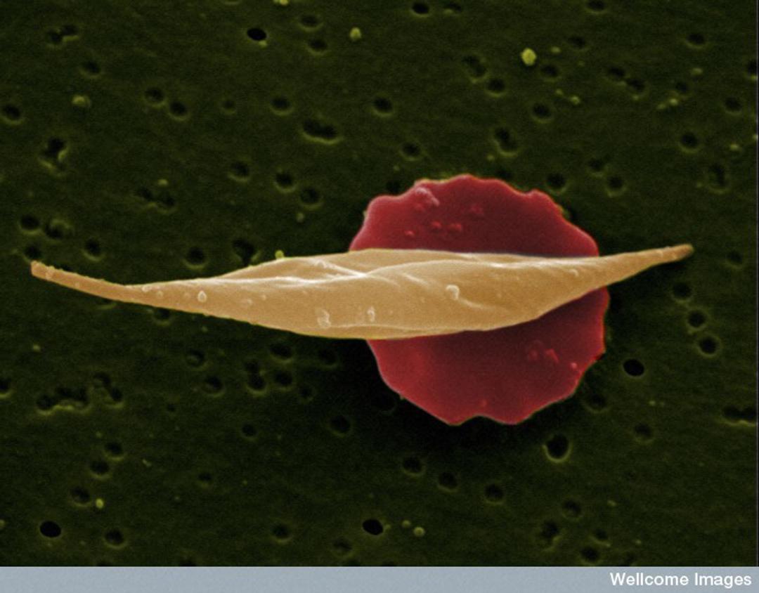Les étranges cellules humaines en 17 photos