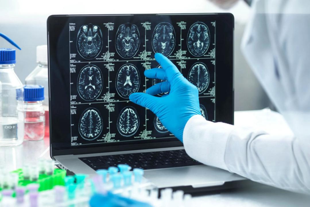 Votre cerveau ne serait pas vraiment « adulte » avant 30 ans : ce que ...