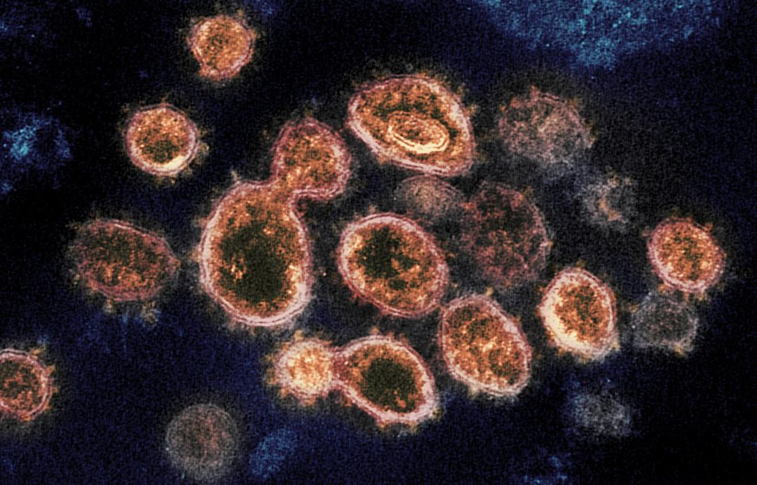 Six dangereux virus créés en laboratoire
