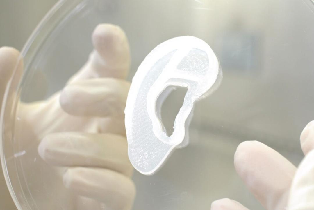 Une oreille imprimée en 3D a été greffée sur un être humain pour la ...
