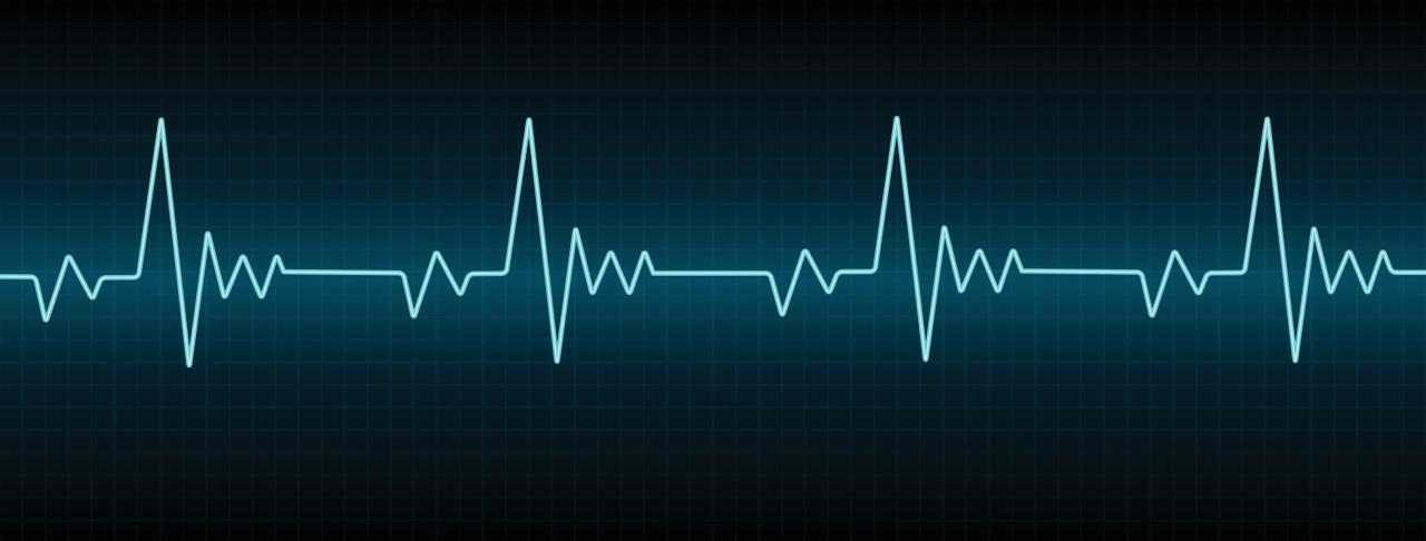 Définition | Électrocardiogramme : qu'est-ce que c'est ? | Futura santé