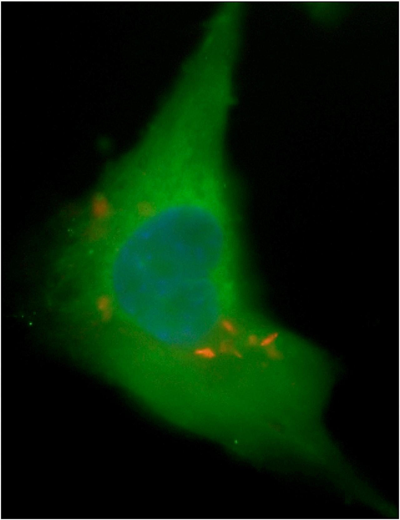 L’agent de la tuberculose se cache dans les os