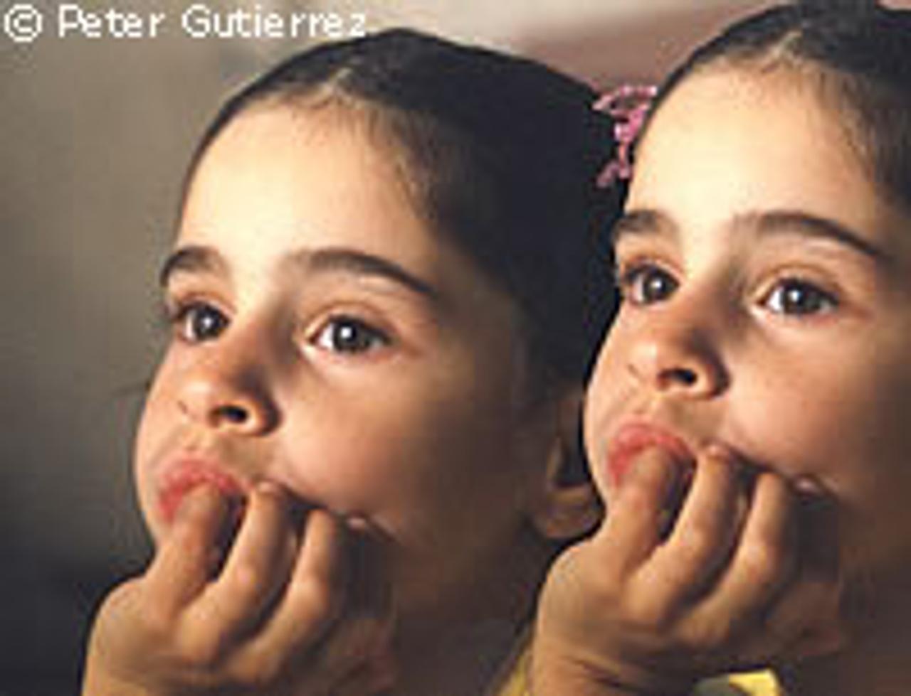 Le mystère des différences entre vrais jumeaux dévoilé