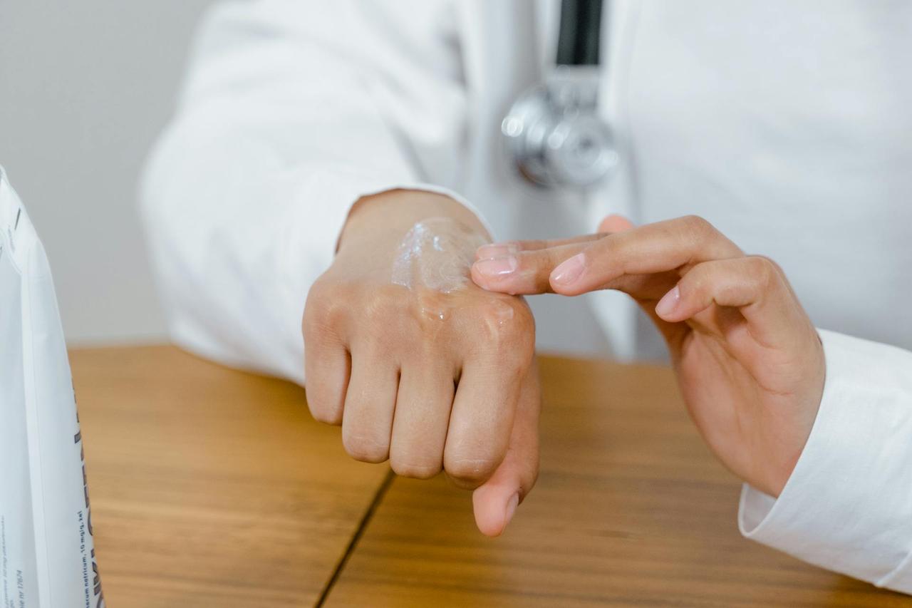 Eczéma des mains : comment prévenir les récidives