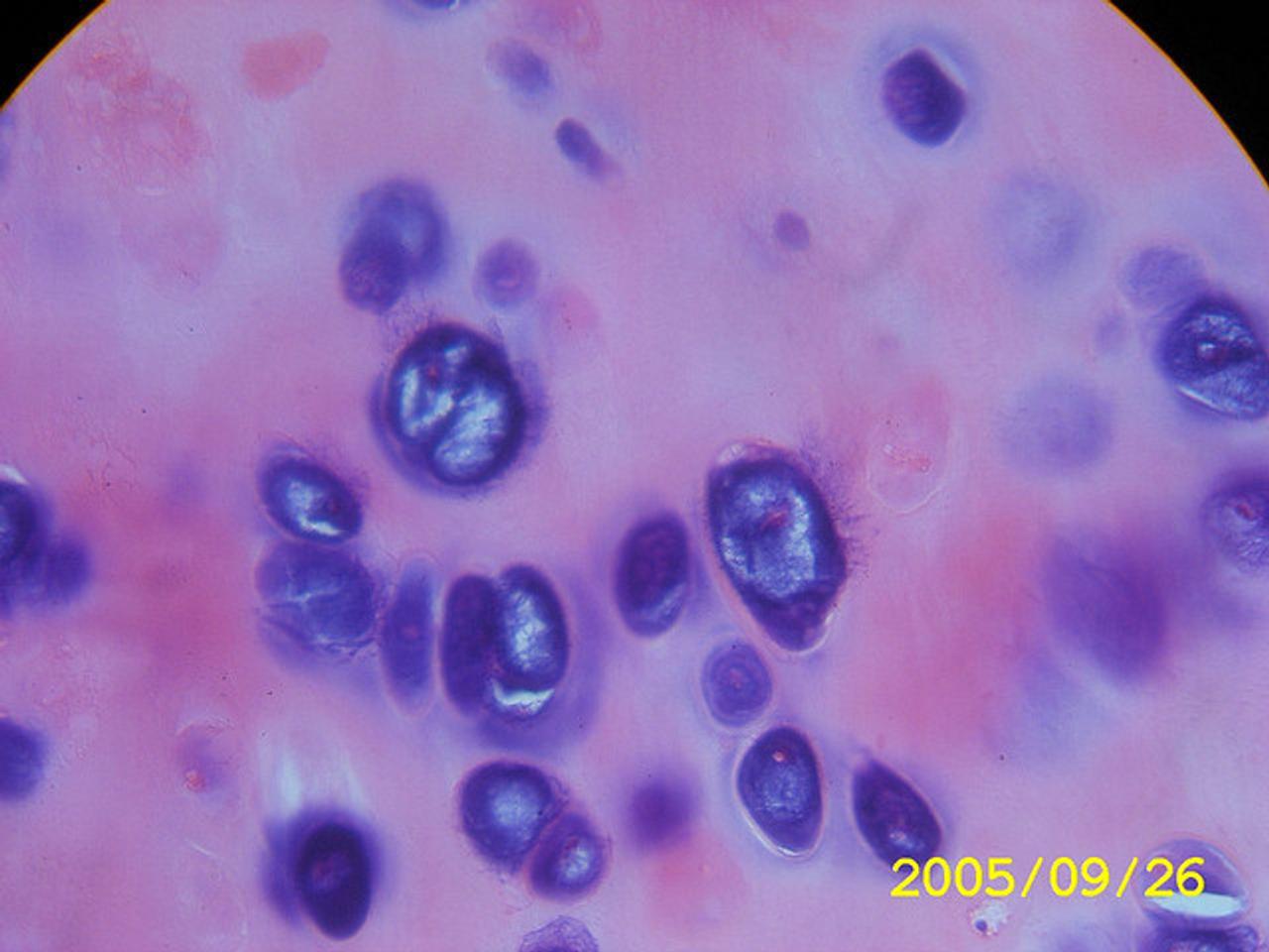 Définition | Hyalin : qu'est-ce que c'est ? | Futura sciences