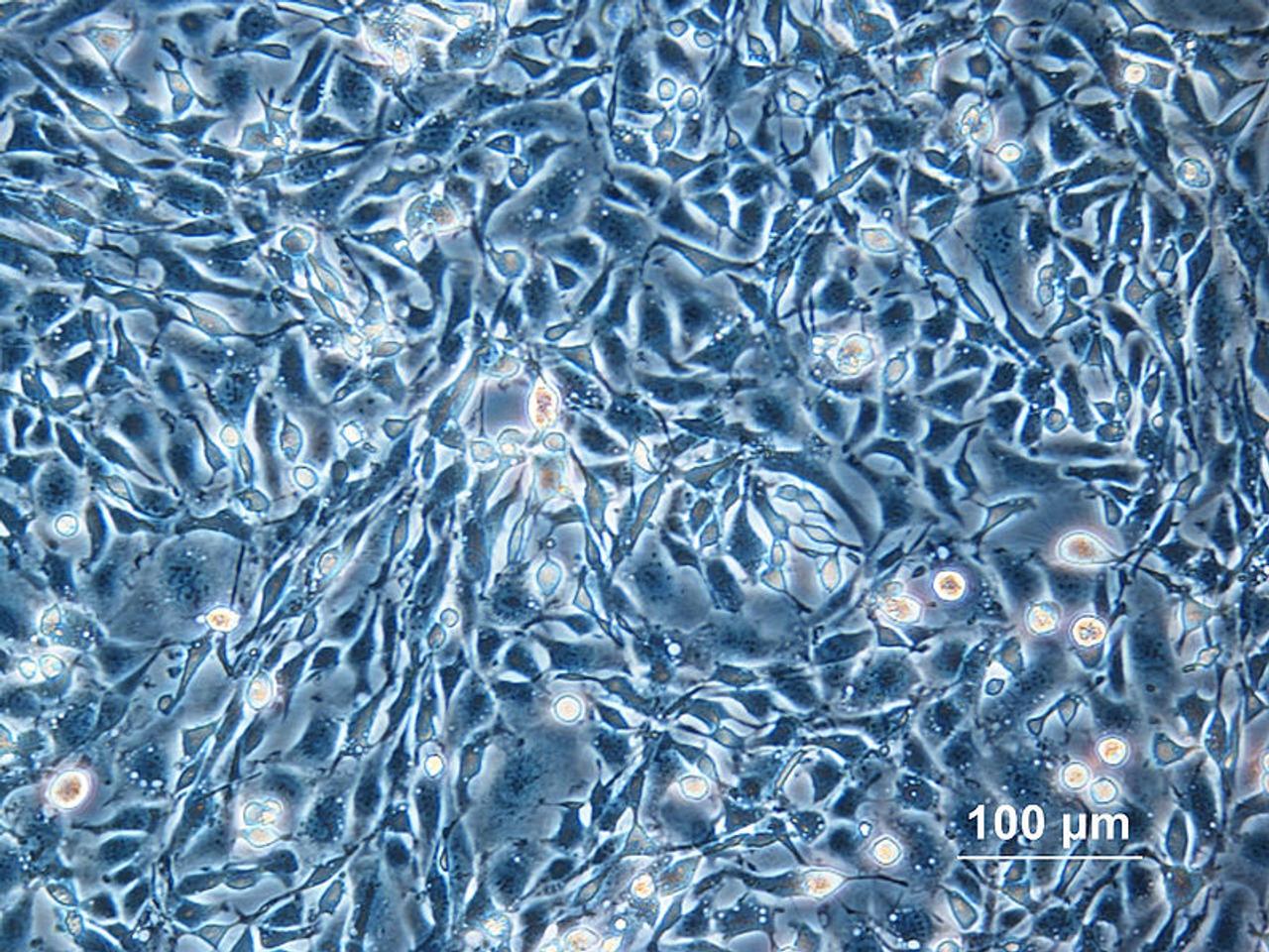 Définition | Microscope inversé : qu'est-ce que c'est ? | Futura santé