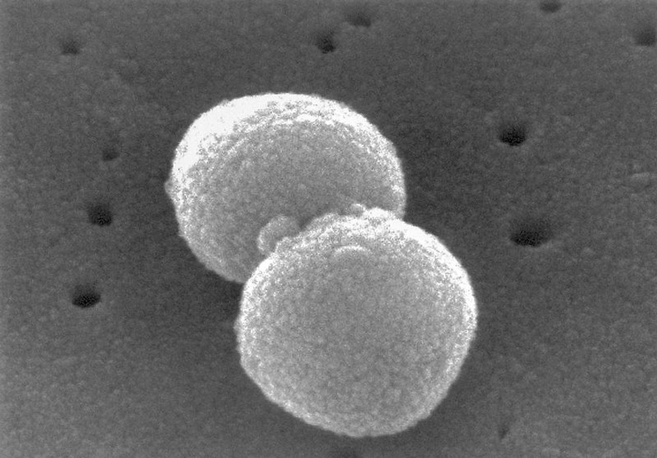 Définition | Pneumocoque : qu'est-ce que c'est ? | Futura santé