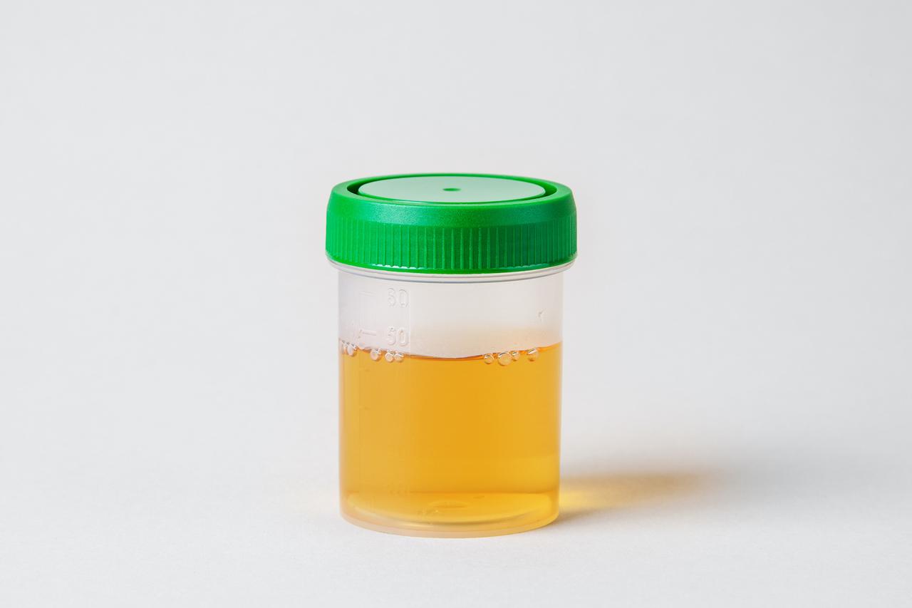 En vidéo : que révèle la couleur de l'urine sur votre santé