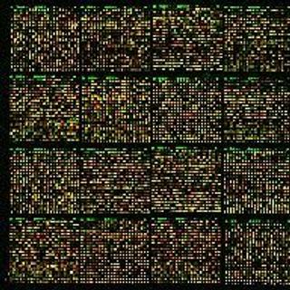 IST et MST : quelle différence
