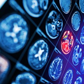 Définition | Insula : qu'est-ce que c'est ? | Futura santé