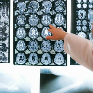 Définition | Promoteur : qu'est-ce que c'est ? | Futura santé