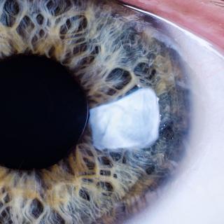 Définition | Allantoïde : qu'est-ce que c'est ? | Futura santé