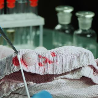 Définition | Complexe immun : qu'est-ce que c'est ? | Futura santé