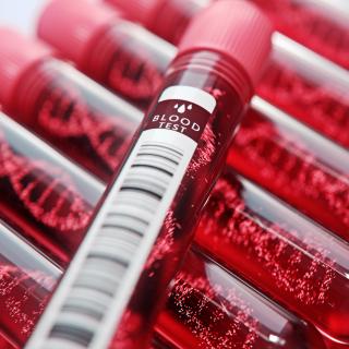 Définition | Facteur Rhésus : qu'est-ce que c'est ? | Futura santé