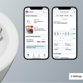 Définition | ECBU (Examen CytoBactériologique des Urines) : qu'est-ce ...