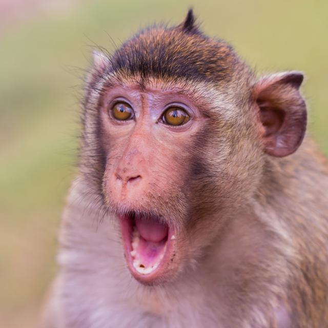 Définition | Neurite : qu'est-ce que c'est ? | Futura santé