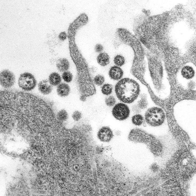 Infections virales : quelles différences entre grippe et rhume