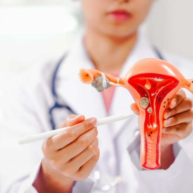 Les Questions Réponses Cancer des ovaires | Futura