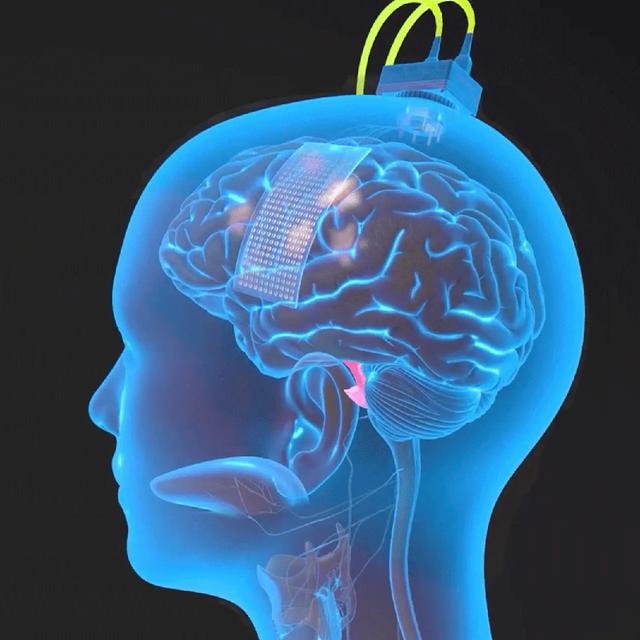 Le futur des commandes mentales se dessine avec IBM et Inclusive Brains