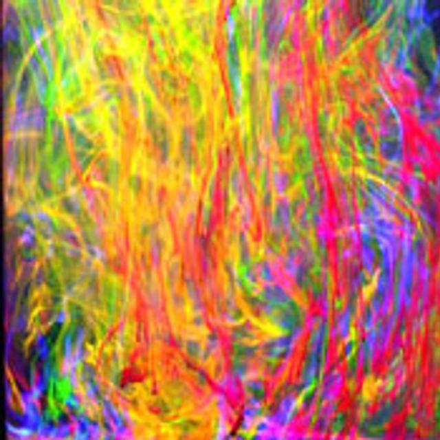 Fluorescence : la couleur fluo