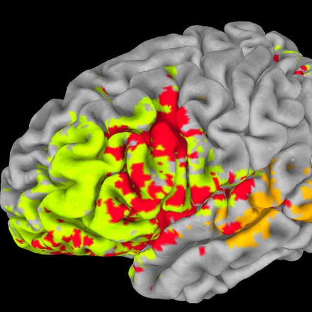Définition | Néocortex : qu'est-ce que c'est ? | Futura santé