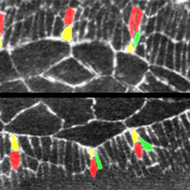 Définition | Exsudat : qu'est-ce que c'est ? | Futura santé