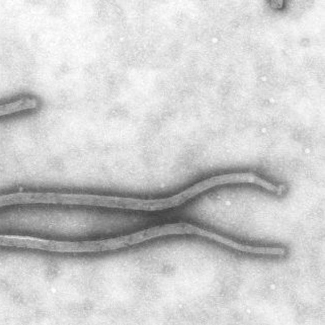 Ébola : un traitement français bientôt en essai clinique