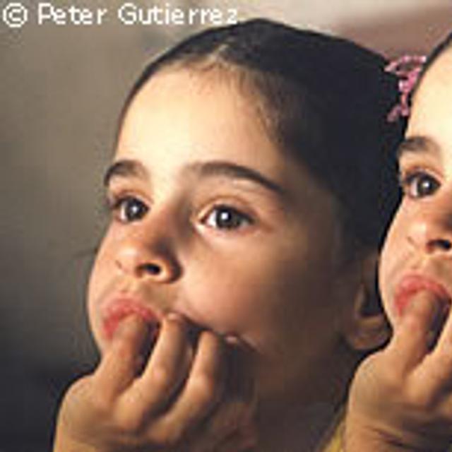 Des vrais jumeaux pas parfaitement identiques…