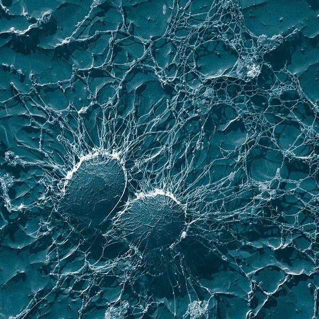 Définition | Staphylocoque doré : qu'est-ce que c'est ? | Futura santé
