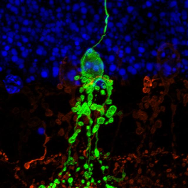 Définition | Pollution organique : qu'est-ce que c'est ? | Futura planète