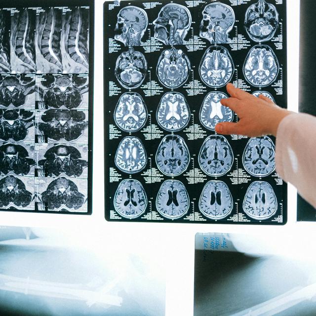 Définition | Pathologique : qu'est-ce que c'est ? | Futura santé