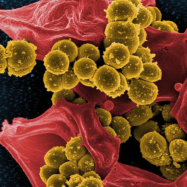 Botulisme : comment s'attrape-t-il et quels sont ses symptômes