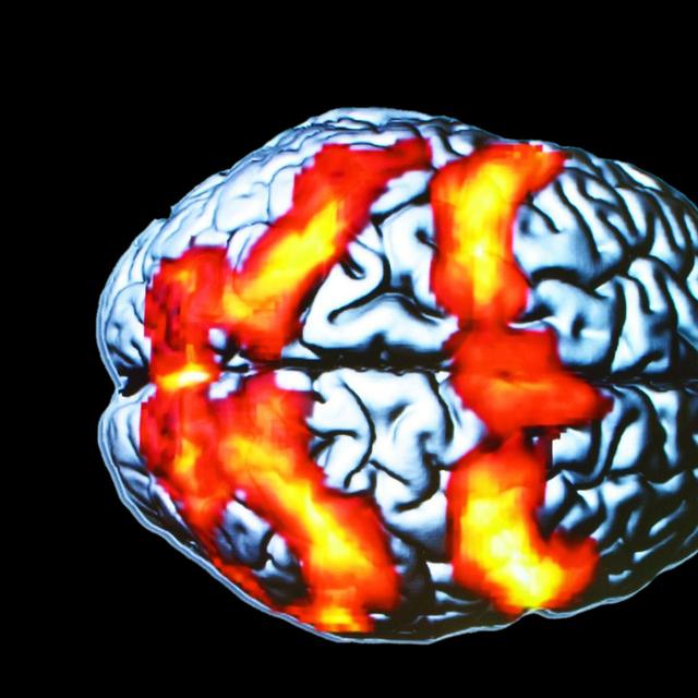 Définition | Rayonnement thermique : qu'est-ce que c'est ? | Futura ...
