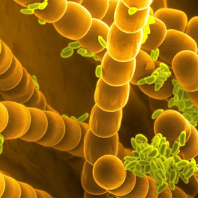 Définition | Plasmodesme : qu'est-ce que c'est ? | Futura planète