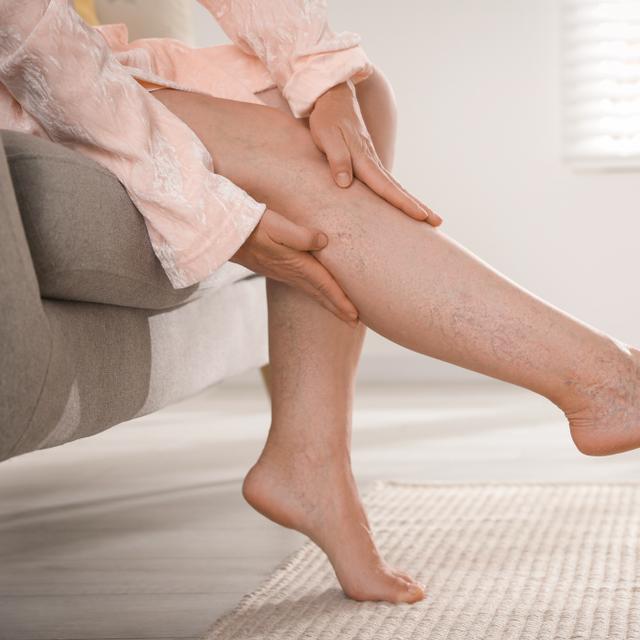 Définition | Hypervolémie : qu'est-ce que c'est ? | Futura santé