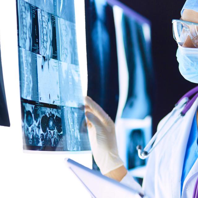 Définition | Syndrome de Protée : qu'est-ce que c'est ? | Futura santé