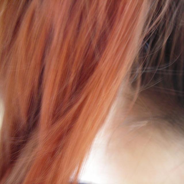 Définition | Exsudat : qu'est-ce que c'est ? | Futura santé