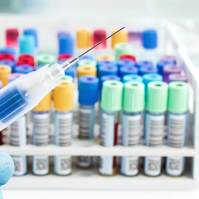 Comment lire et comprendre un bilan sanguin