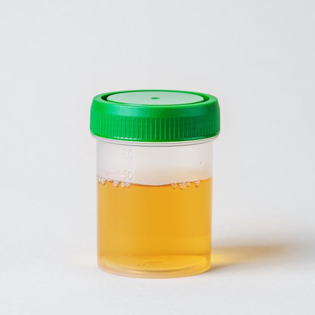Définition | Uretère : qu'est-ce que c'est ? | Futura santé