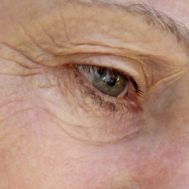 Test d'astigmatisme : comment savoir si je suis astigmate