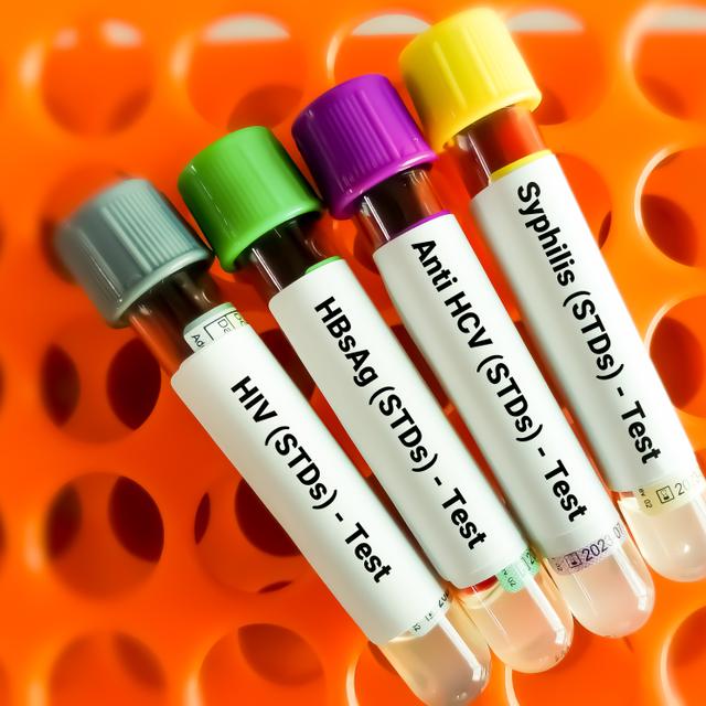 Définition | MST : qu'est-ce que c'est ? | Futura santé