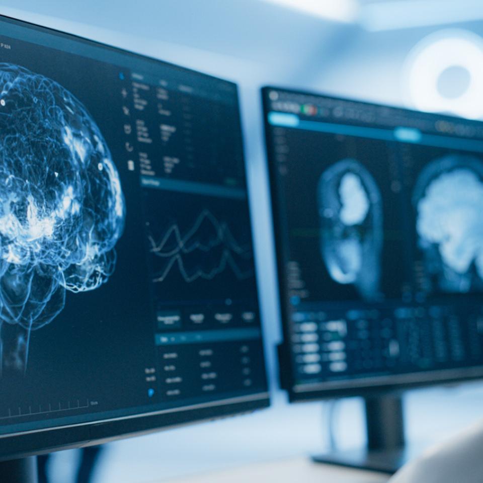 Définition | Neurite : qu'est-ce que c'est ? | Futura santé