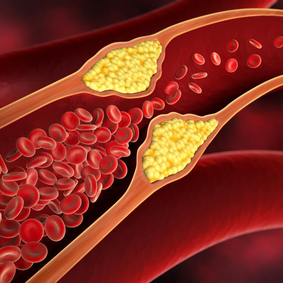 Définition | Neurite : qu'est-ce que c'est ? | Futura santé
