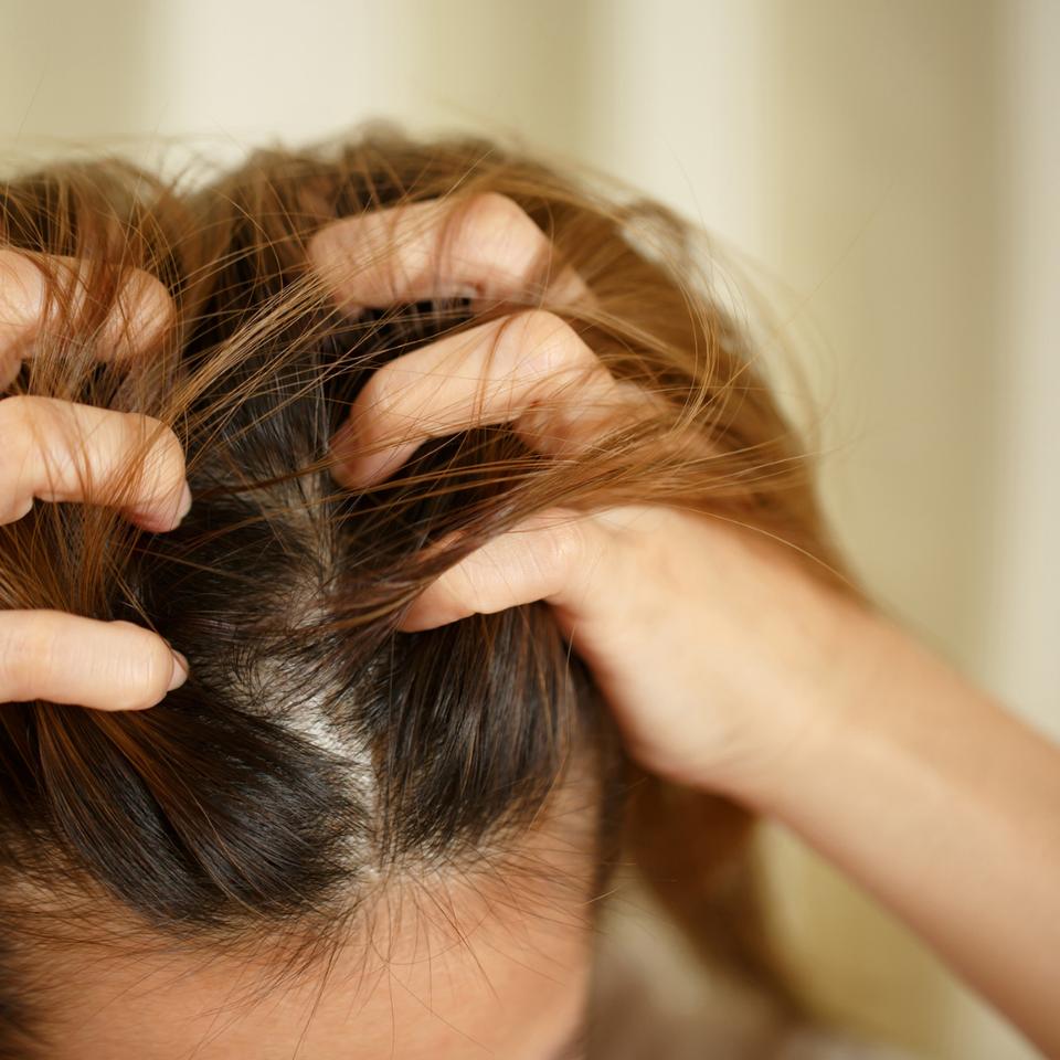 Voici les 15 meilleurs traitements du cuir chevelu sec pour soulager ...