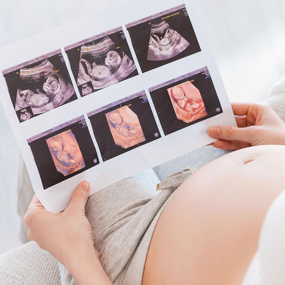 Accouchement : les contractions