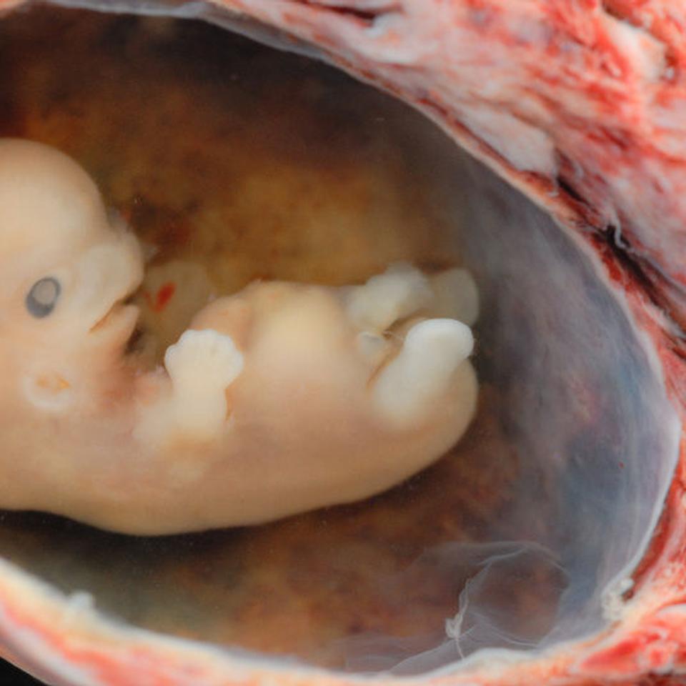 Définition | Allantoïde : qu'est-ce que c'est ? | Futura santé