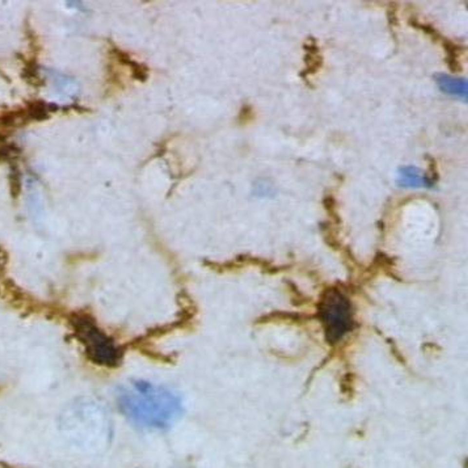 Définition | Microglie : qu'est-ce que c'est ? | Futura santé