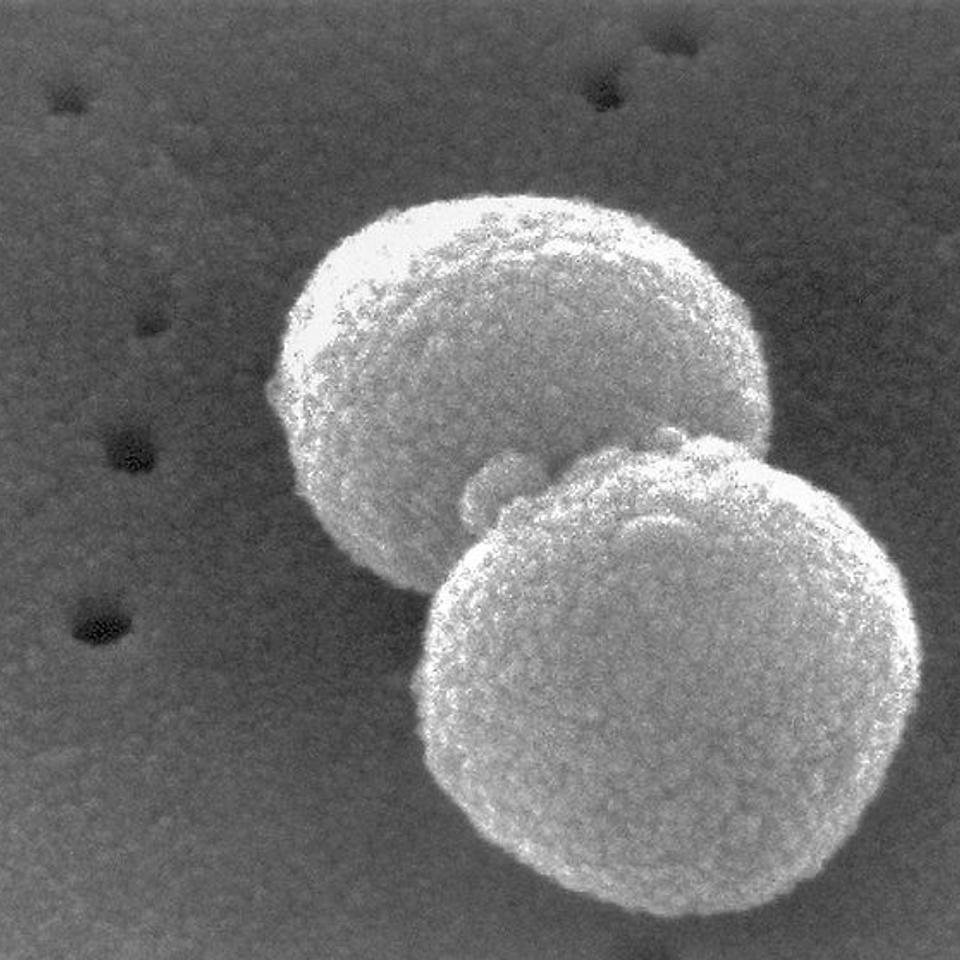 Définition | Pneumocoque : qu'est-ce que c'est ? | Futura santé