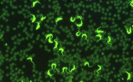 Une bithérapie enfin efficace contre la maladie du sommeil